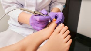 How to Know if Toenail Fungus is Dying?